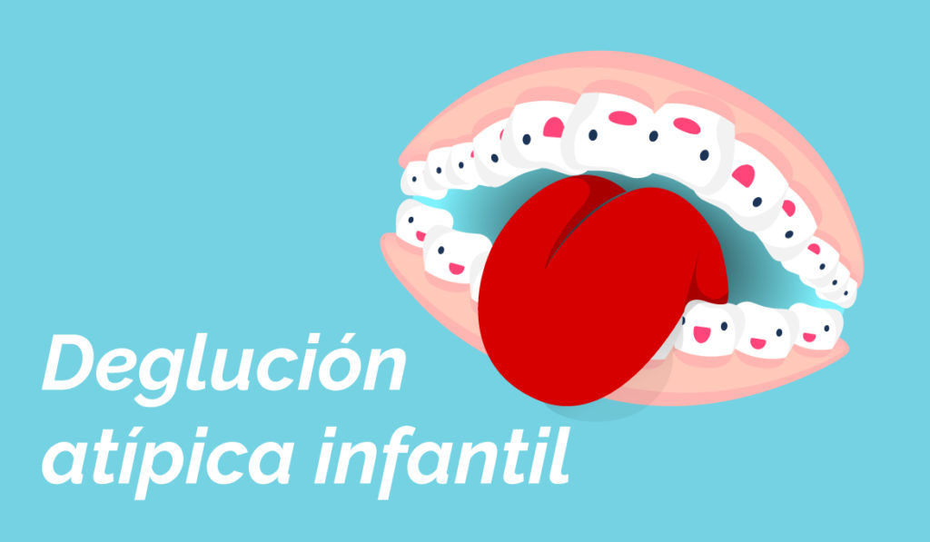 deglucion - dentistainfantiltoledo.com